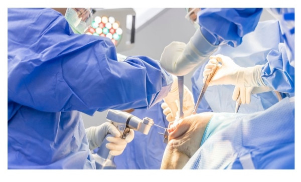 Total Knee Replacement ( TKR ) Kit